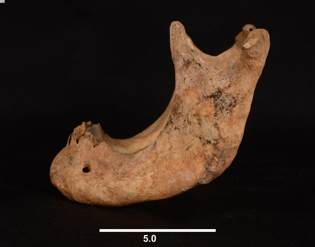 Journal of Bioanthropology 1/2021: A possible case of Gigantism and/or ...